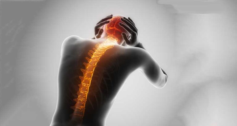 The Symptoms and Causes of Spinal Headaches - Colorado Pain Care